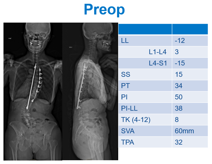 Individualized Surgical Planning using the #MEANS concepts – Sardar ...